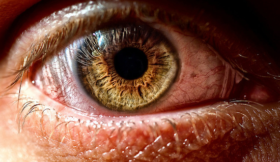 Rare Tumor Causes Hair to Grow on Man's Eyeball | The Mary Sue