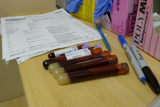 Science Can Use Blood To Determine If Your Death Is Imminent | The Mary Sue