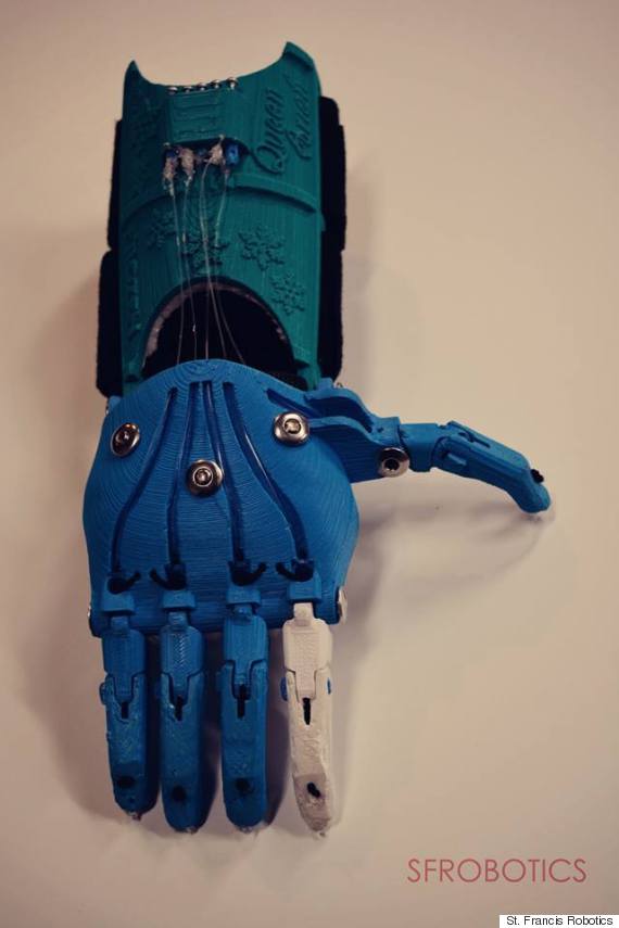 8th Graders Craft Frozen Inspired Prosthetic Hand for Little Girl | The ...