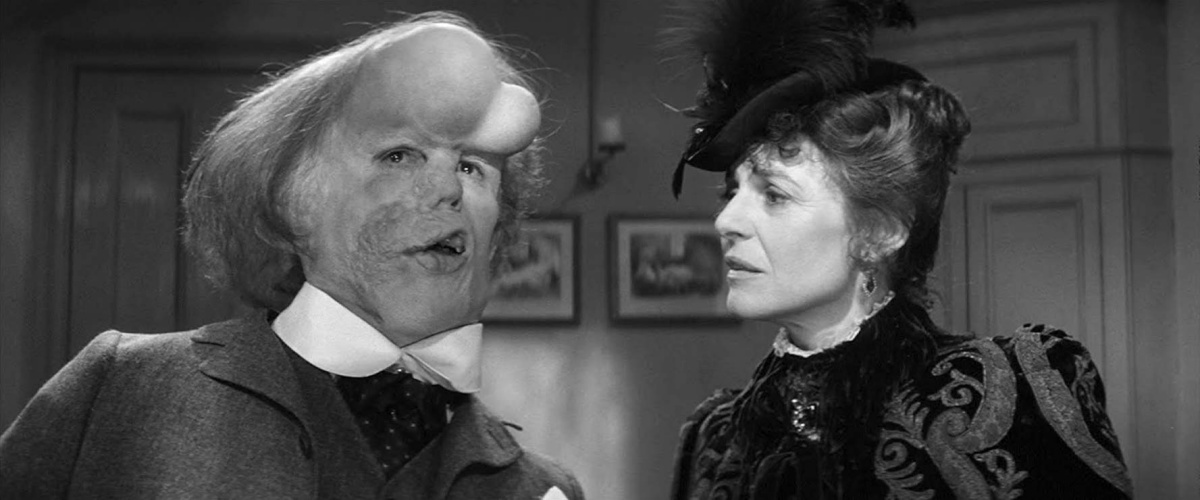 The Elephant Man Casting Facing Backlash from Activists | The Mary Sue